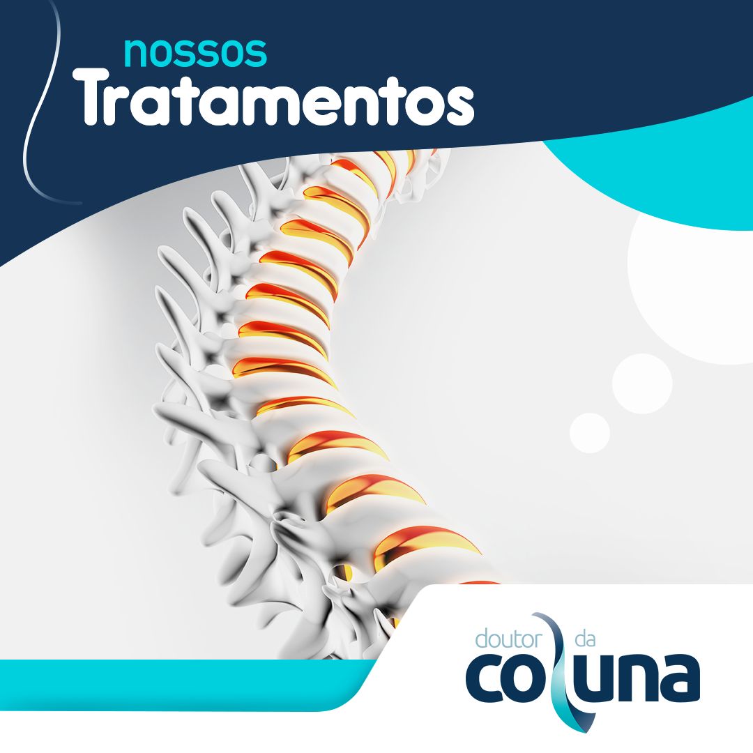 Nossos Tratamentos - Doutor da Coluna